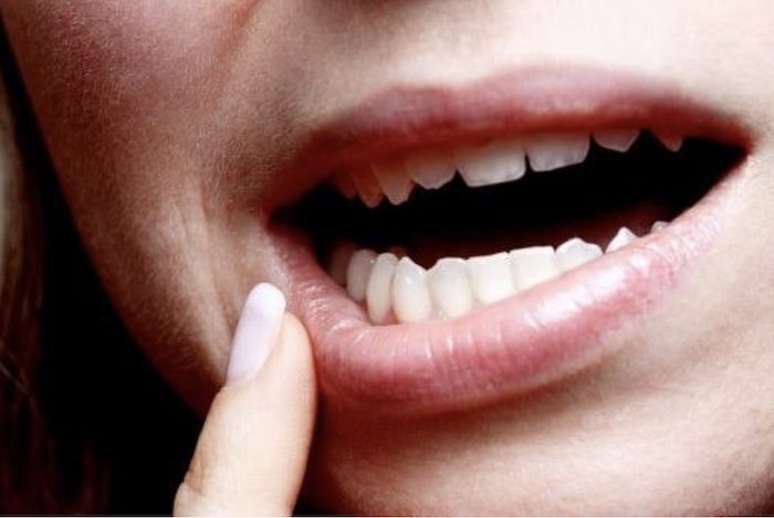 Did You Know How Many Problems You Could Solve With Rubbing Alcohol?